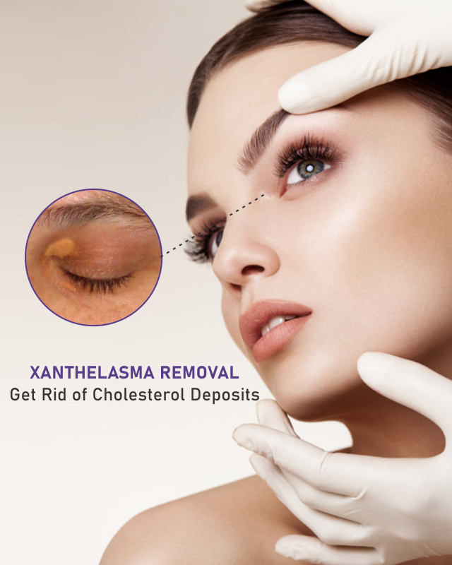 Royal Lush Skin Clinic Saket | Best dermatologist, aesthetic & hair ...